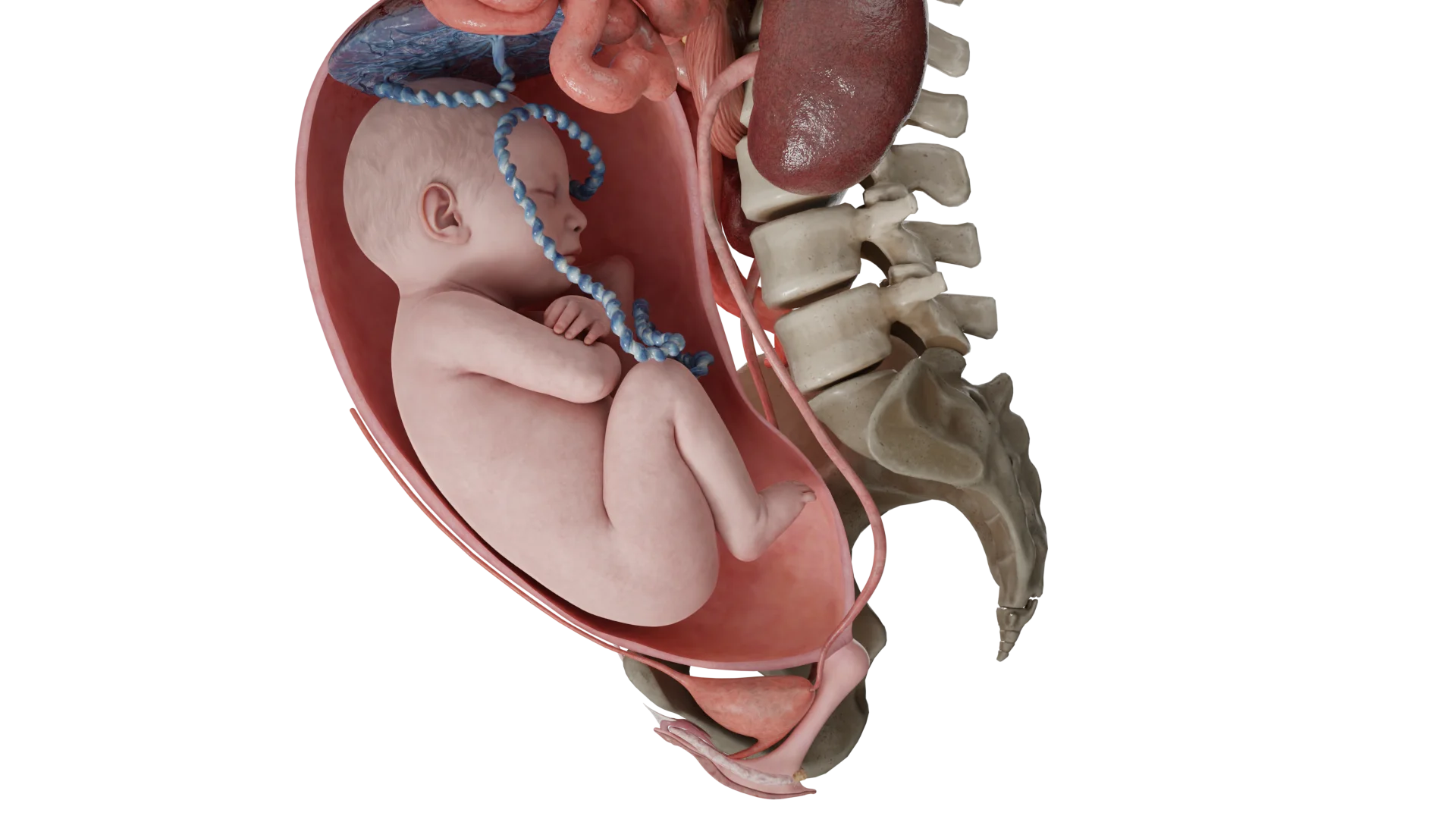 3D Model of Single Footling Breech Presentation | VOKA